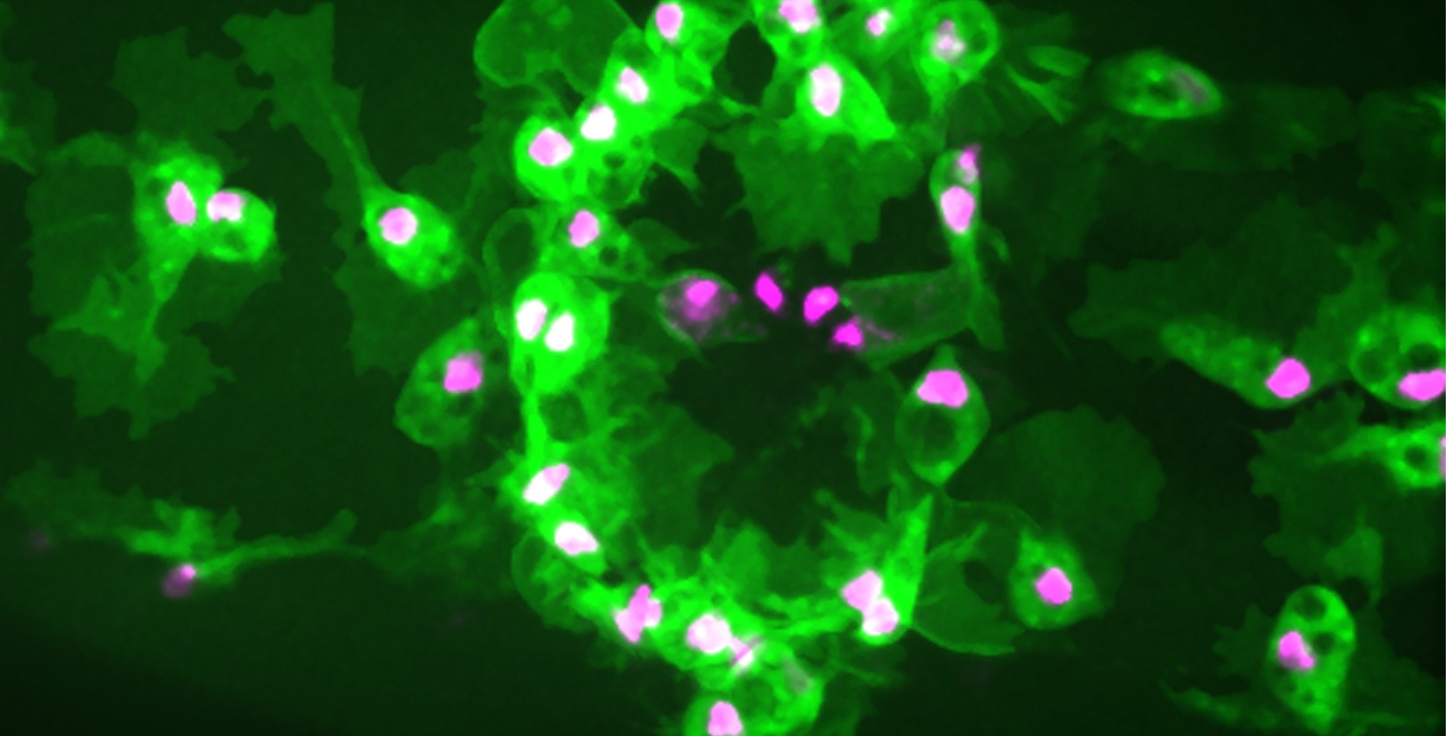 Infection and immunity | Centre for Inflammation Research | Centre for ...