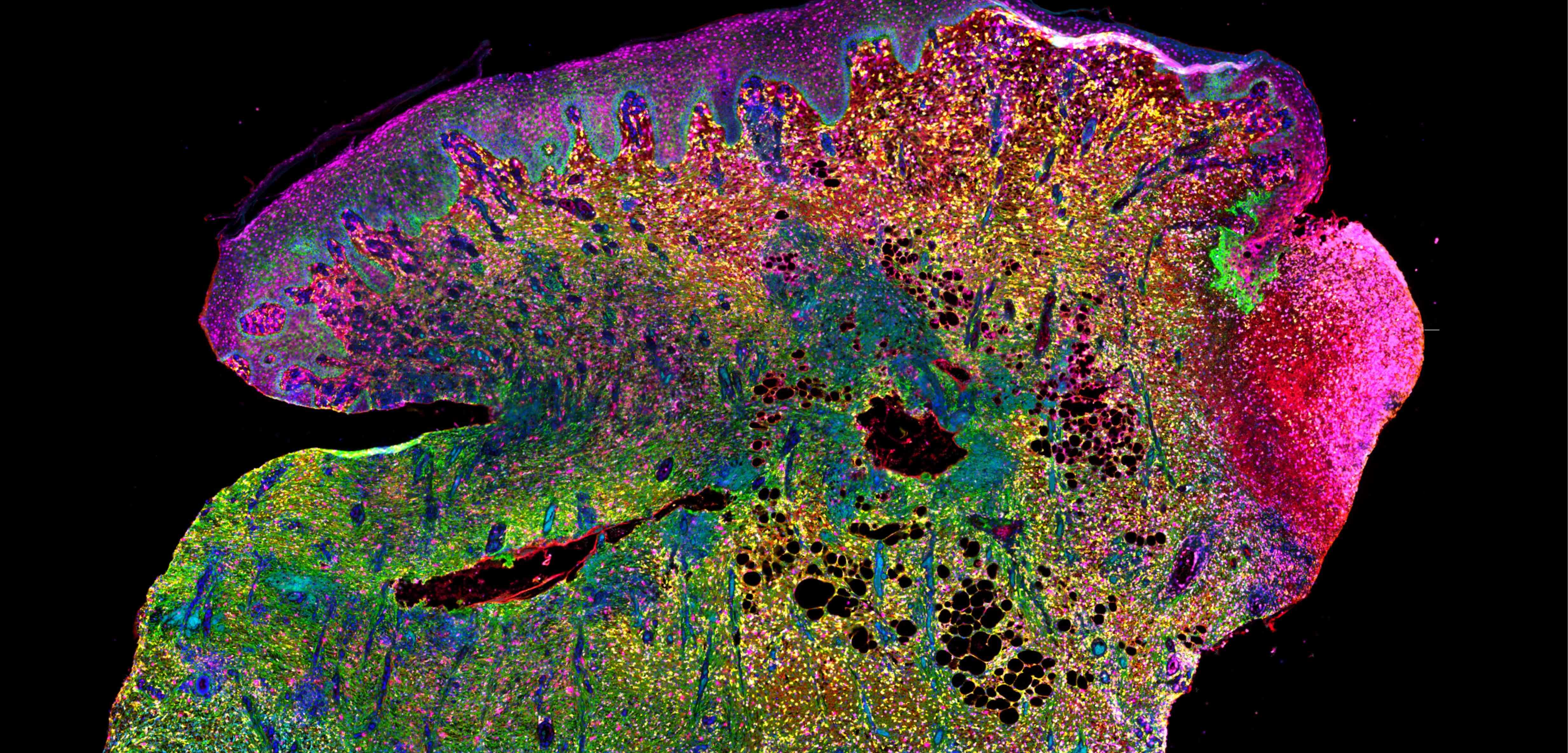 Damage and repair | Centre for Inflammation Research | Centre for ...