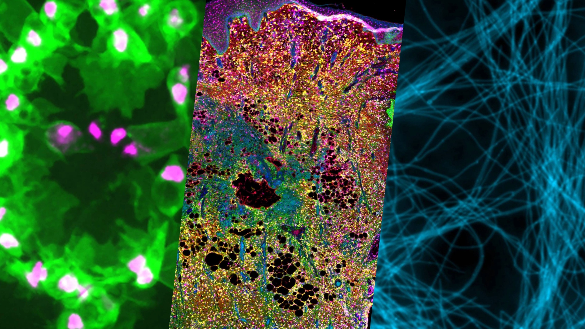 Research themes | Centre for Inflammation Research | Centre for ...